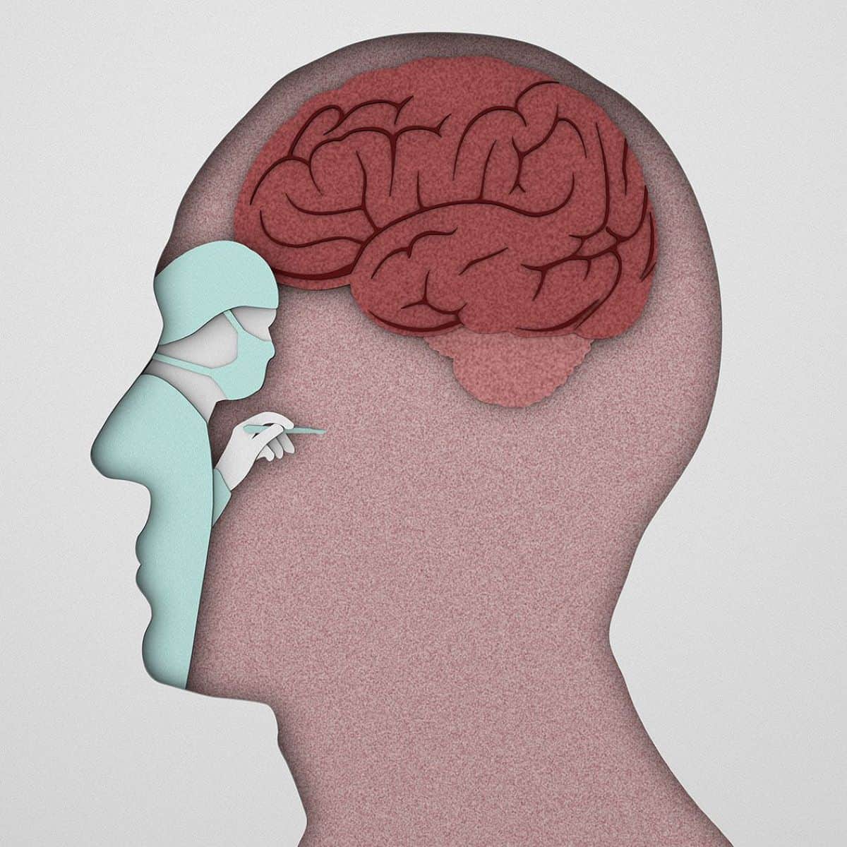 No es una peli de terror: Lobotomía y 'electroshocks' en hospitales ...